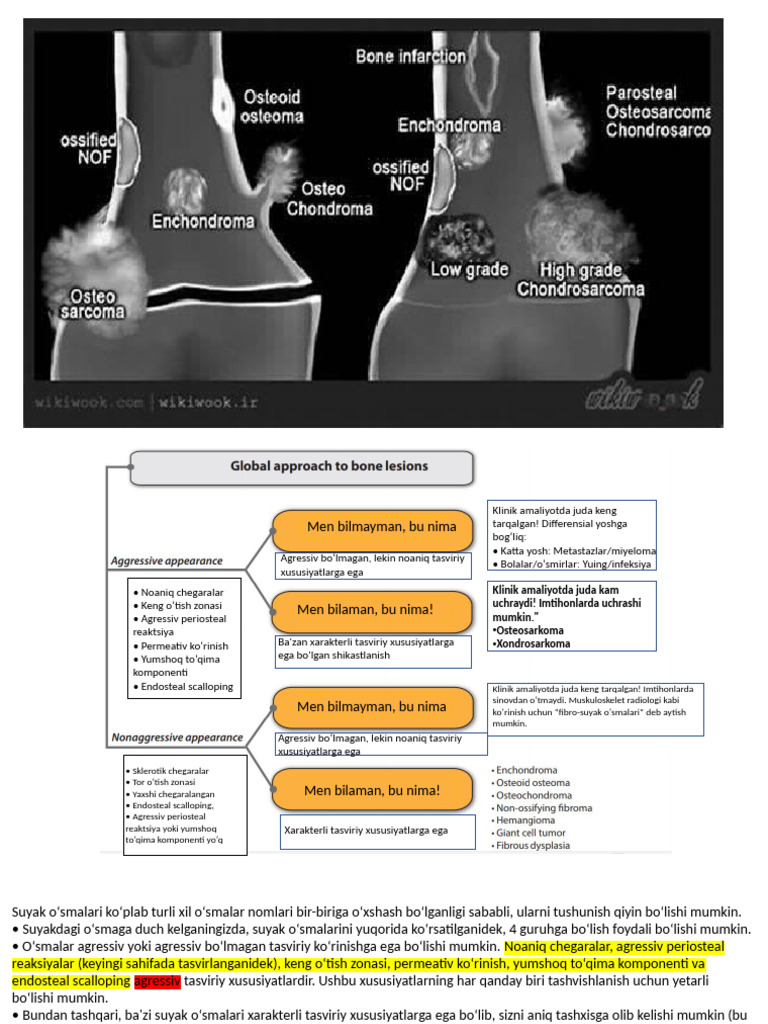 Neoplasm of Bone | PDF