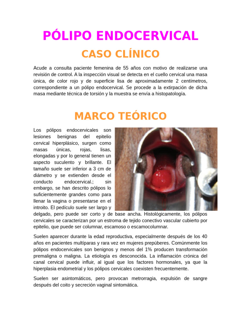 Pólipo Endocervical | PDF | Vagina | Medicina CLINICA