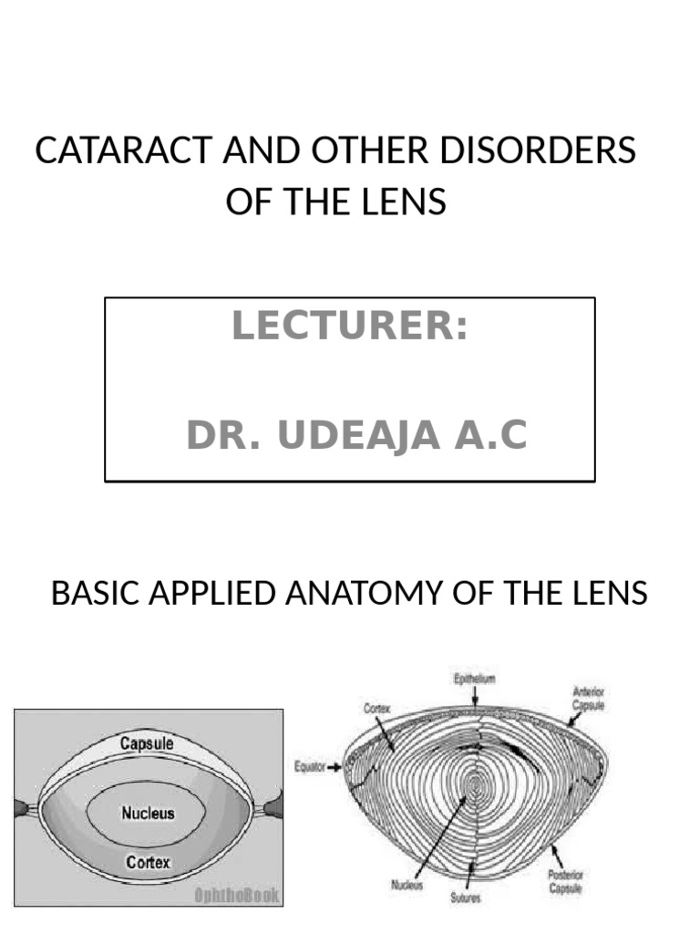 Cataracts and Lens Disorders Overview | PDF | Cataract | Clinical Medicine
