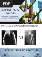 Exeter V40: Femoral Stem Using Exeter Broach | PDF | Surgery | Clinical ...
