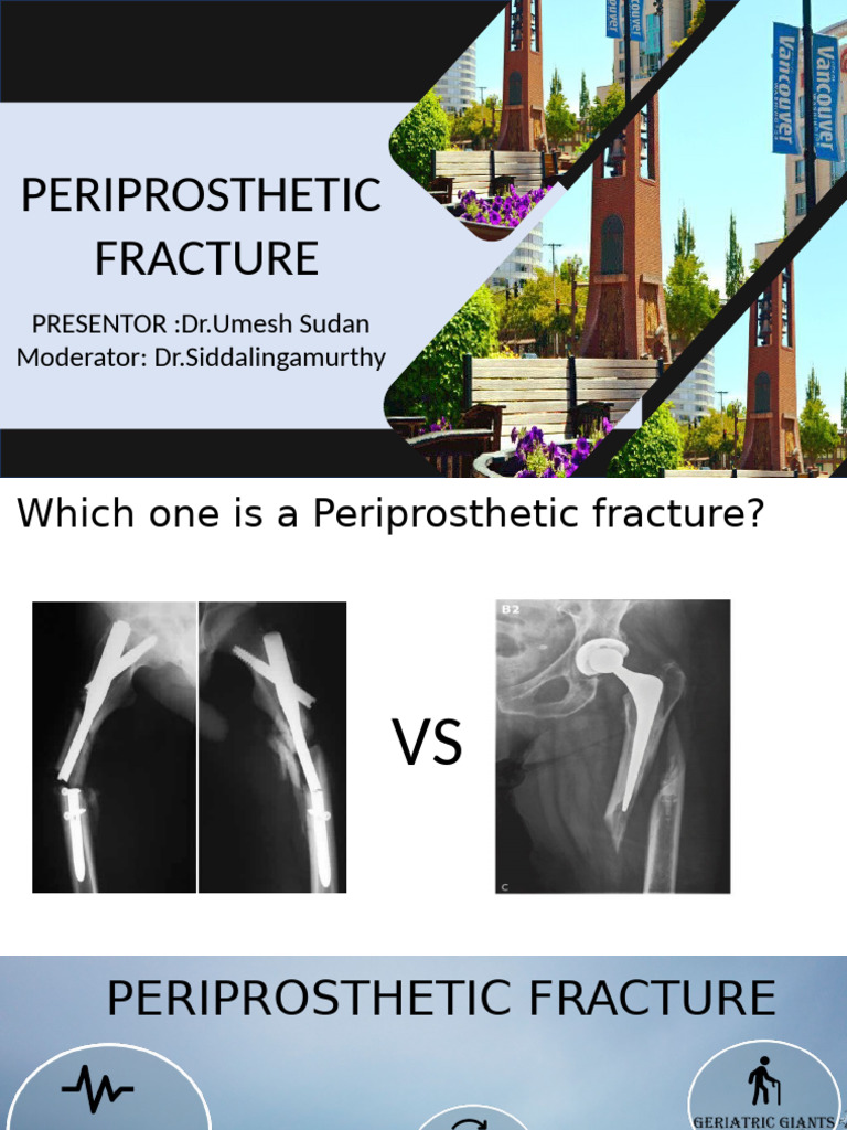 Periprosthetic Fractures With Management | PDF | Knee | Hip