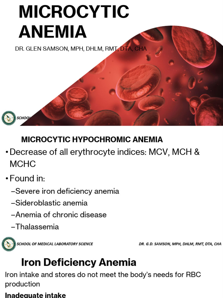 Lecture 6 Microcytic Anemia | PDF | Anemia | Clinical Medicine