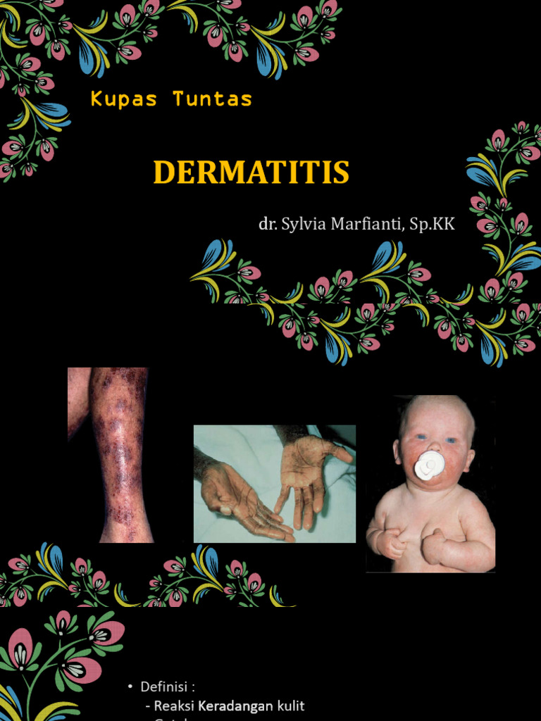 Kupas Tuntas Dermatitis | PDF