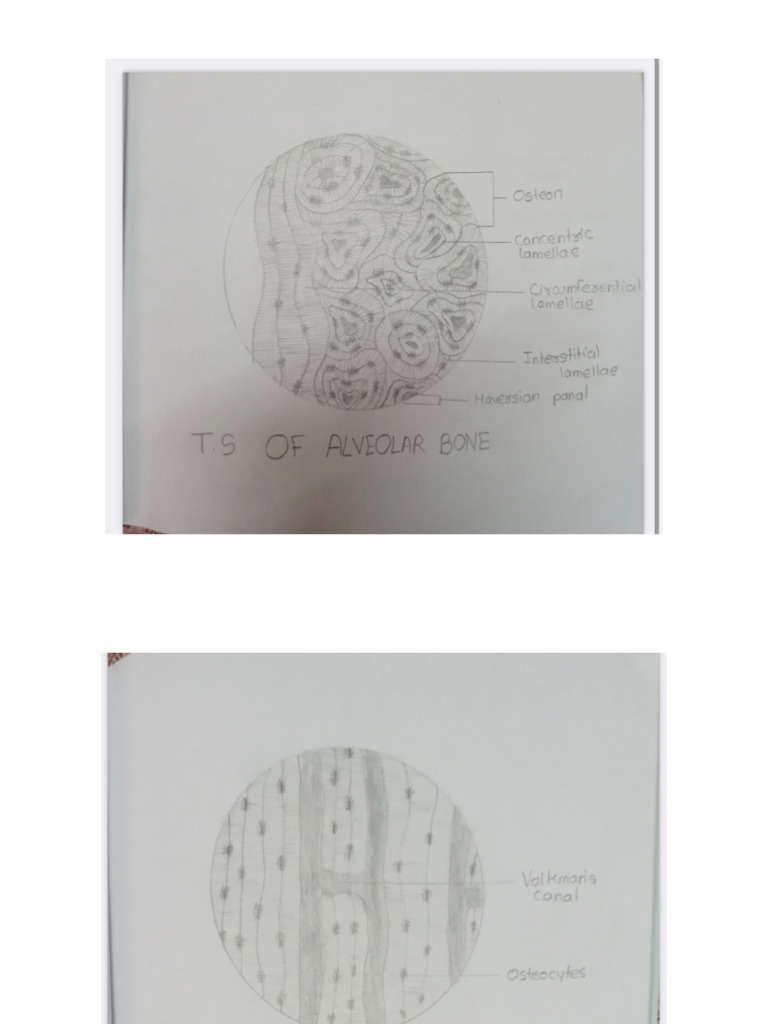Alveolar Bone Diagrams | PDF