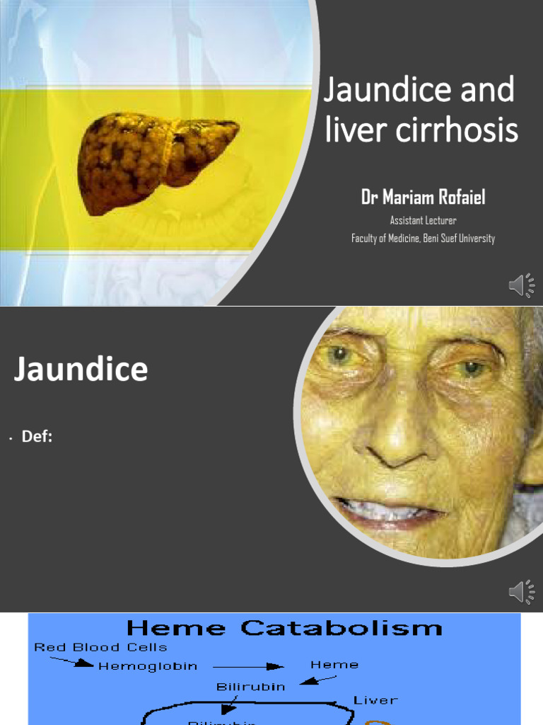 Jaundice and Liver Cirrhosis | PDF | Hepatitis C | Hepatitis