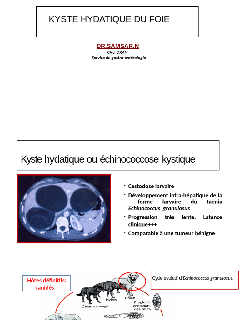 27 - Kyste Hydatique Du Foie | PDF | Maladies et troubles | Médecine ...