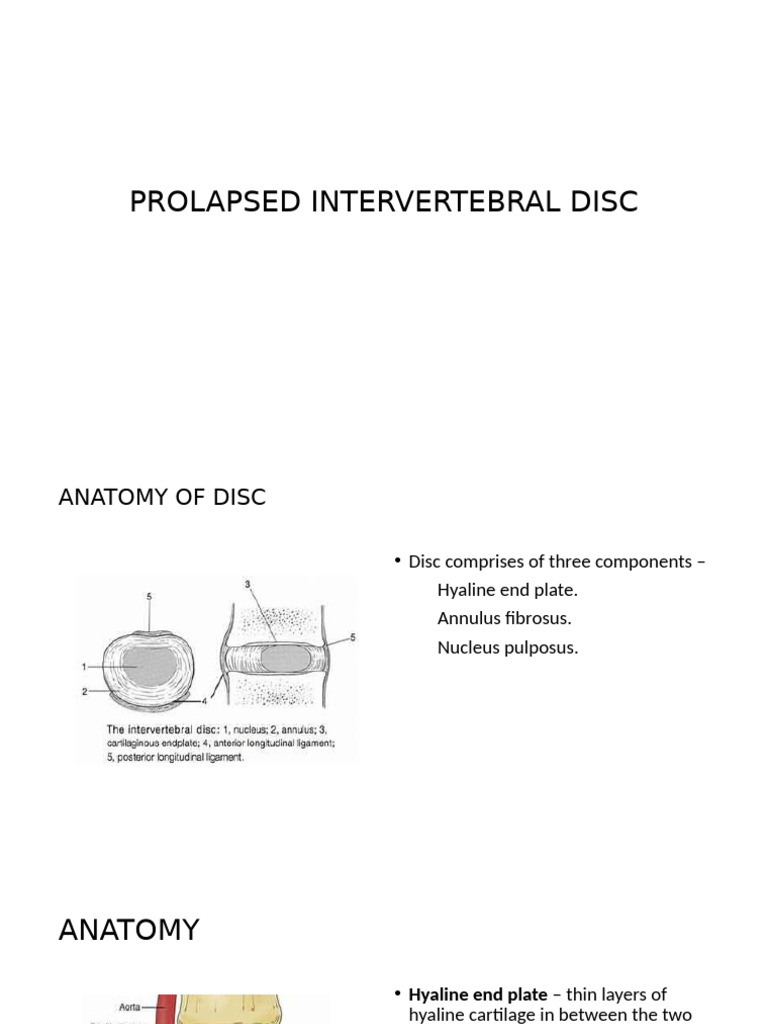Prolapsed Intervertebral Disc-1 | PDF | Diseases And Disorders | Clinical Medicine