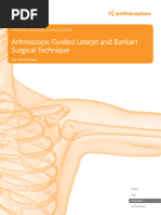 ICONN Answer II Suture Anchor Surgical Protocol Rotator Cuff Repair ...
