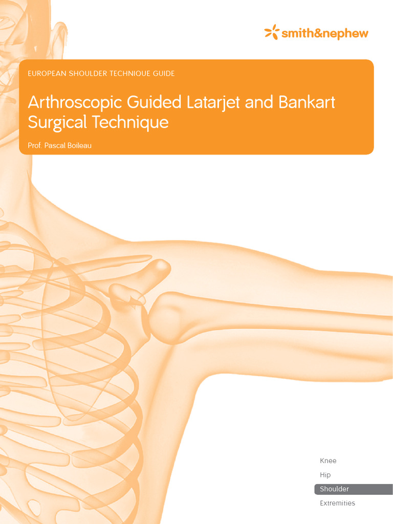 Arthroscopic Latarjet Technique Guide | PDF | Elbow | Shoulder