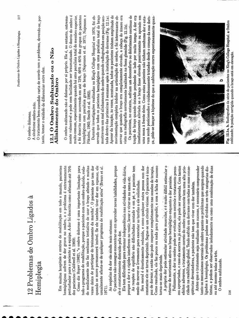 Exercicios Ombro Hemi TDavies | PDF