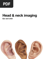 Stenger Test Procedure for Malingering | PDF | Hearing Loss | Ear