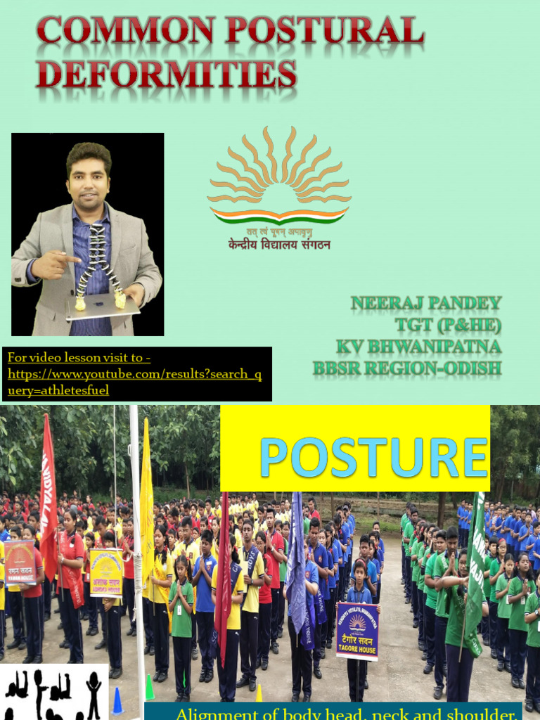 05 posture | PDF | Musculoskeletal System