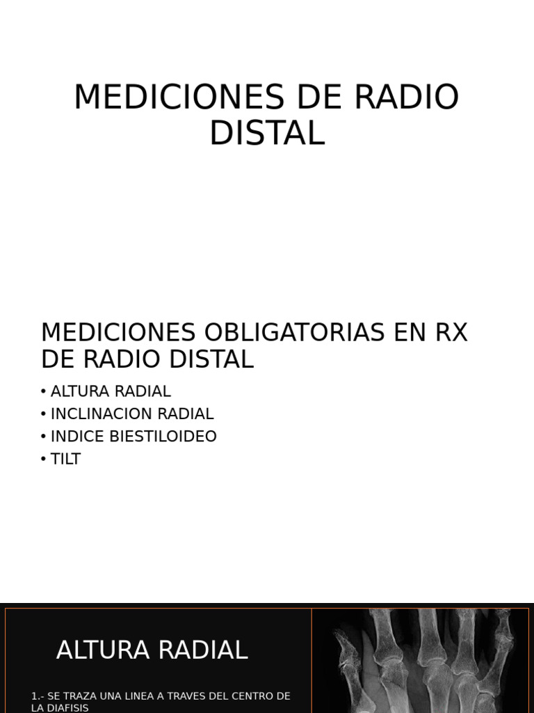 Mediciones Radiográficas del Radio Distal | PDF