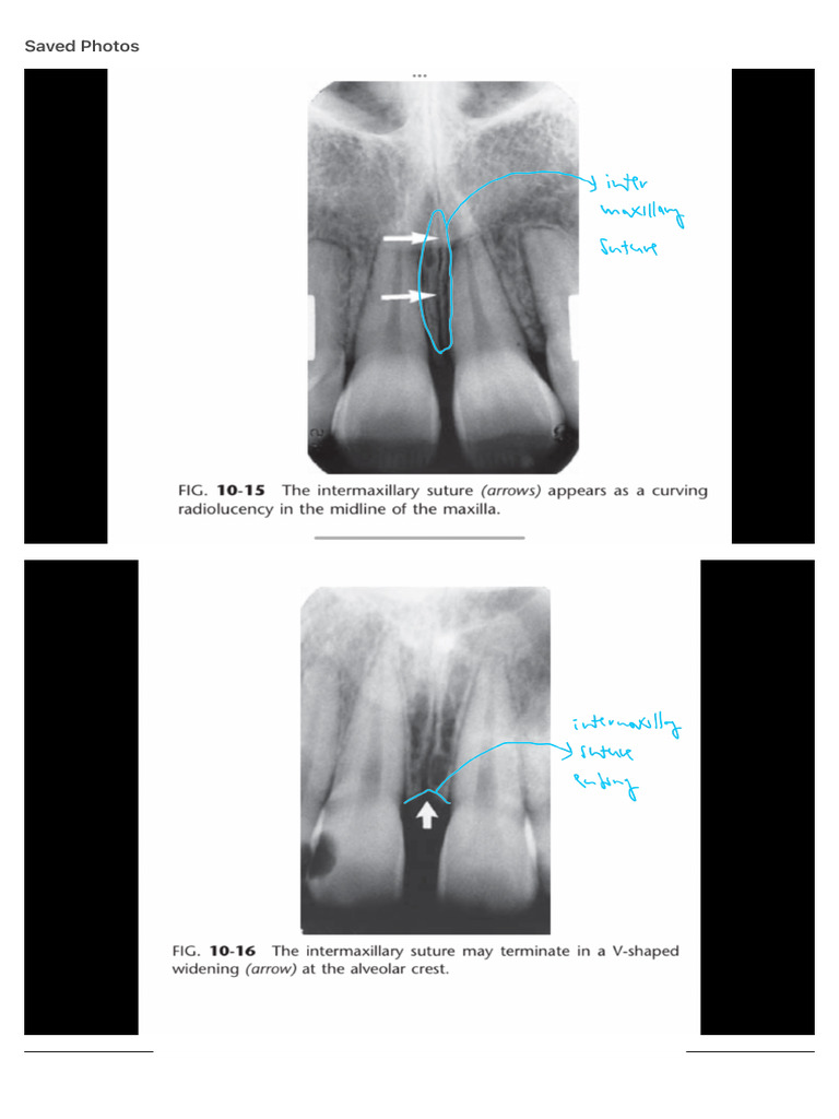 Intraoral Anatomy | PDF