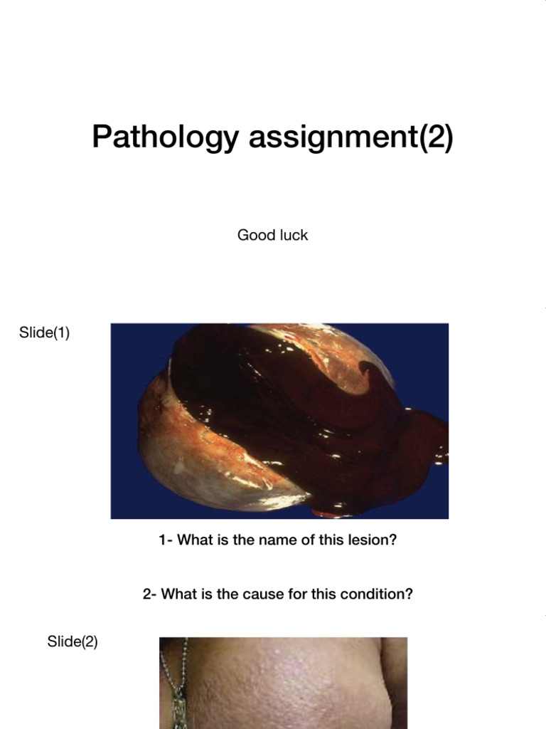 Pathology assignment(2) | PDF