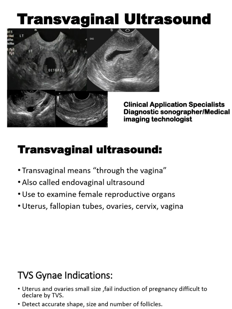 Transvaginal Ultrasound (Final) | PDF | Uterus | Pregnancy