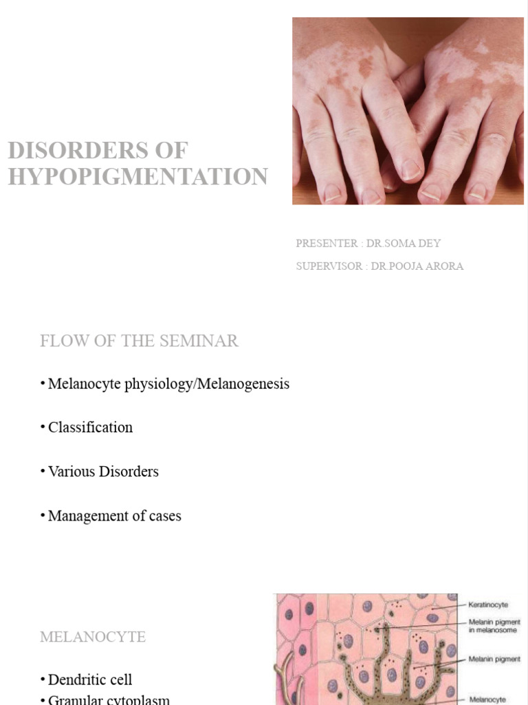 Hypopigmentation Disorders Overview | PDF | Skin | Diseases And Disorders