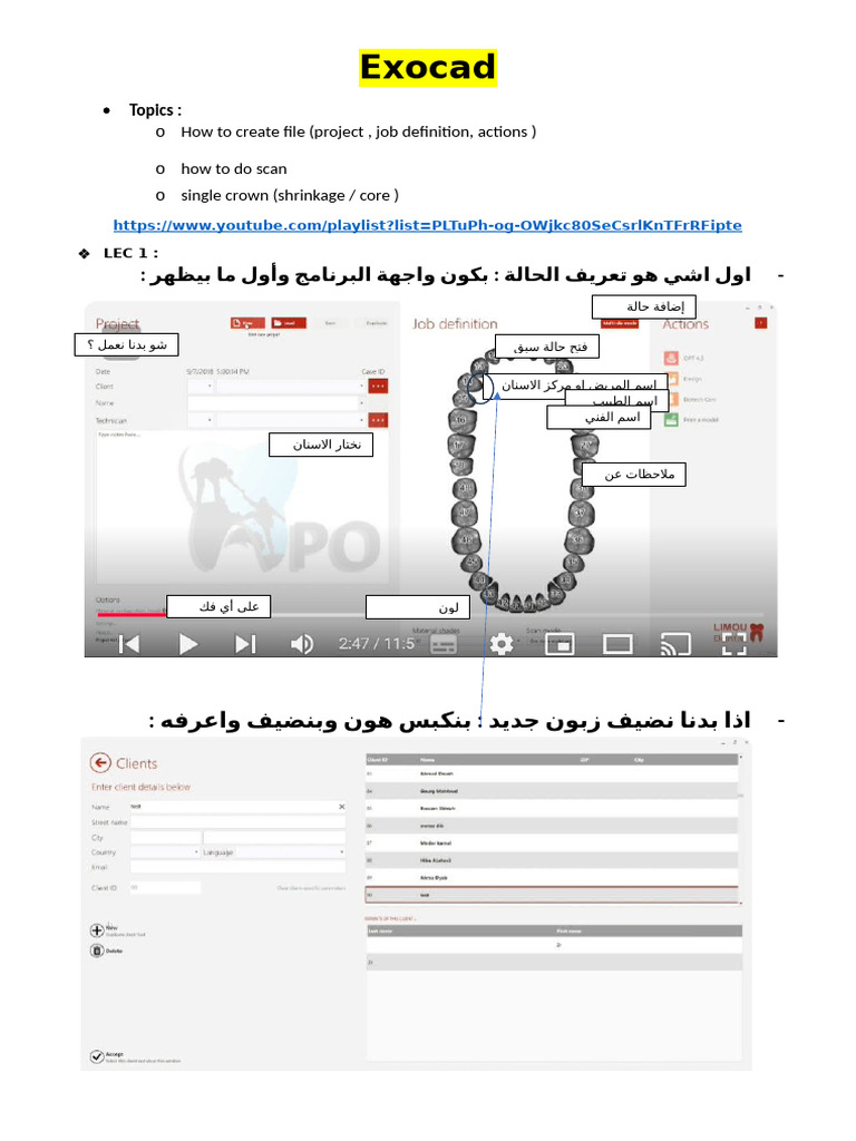 Basic Exocad Cource Youtube | PDF