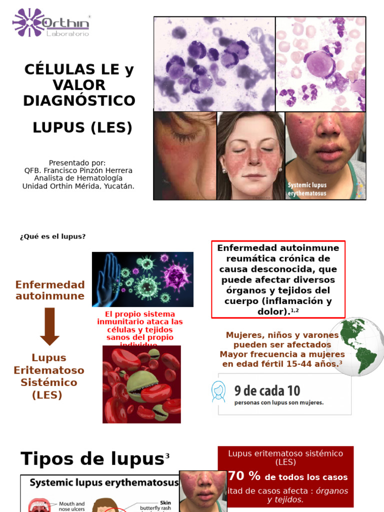 Células LE & Valor Diagnóstico. 2 | PDF | Medicina | Especialidades Medicas
