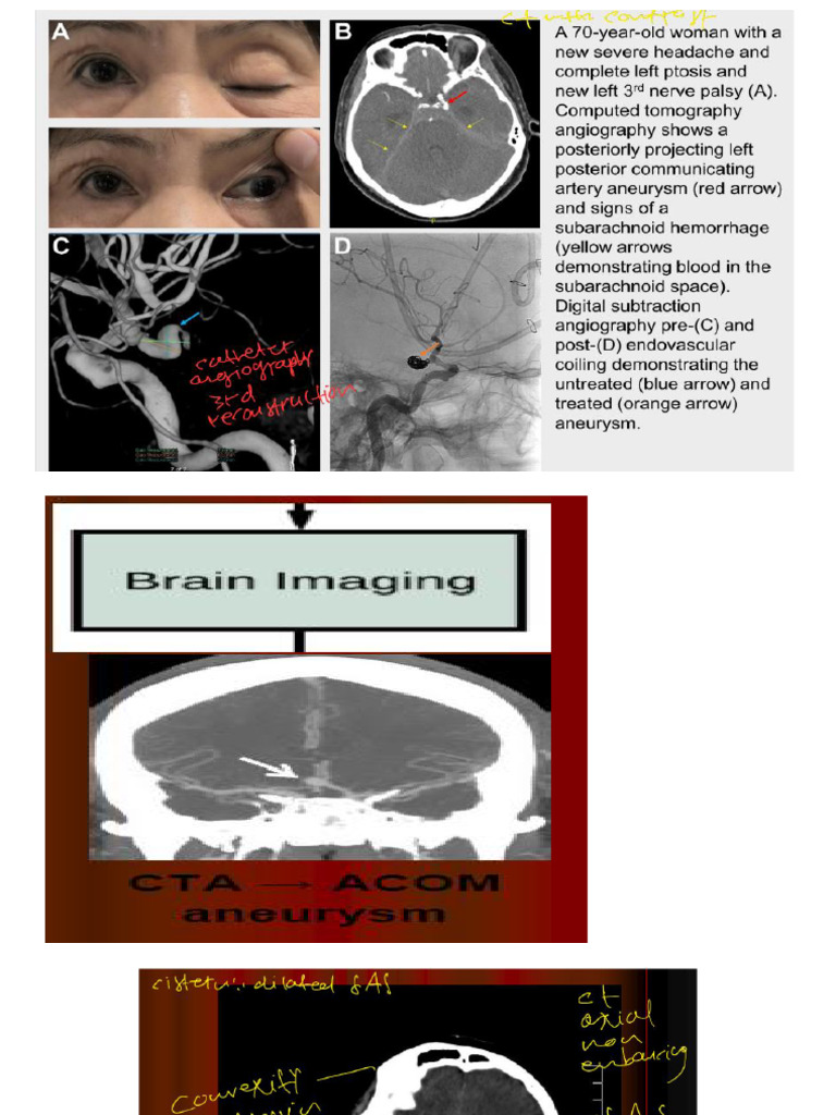 Sah Images | PDF