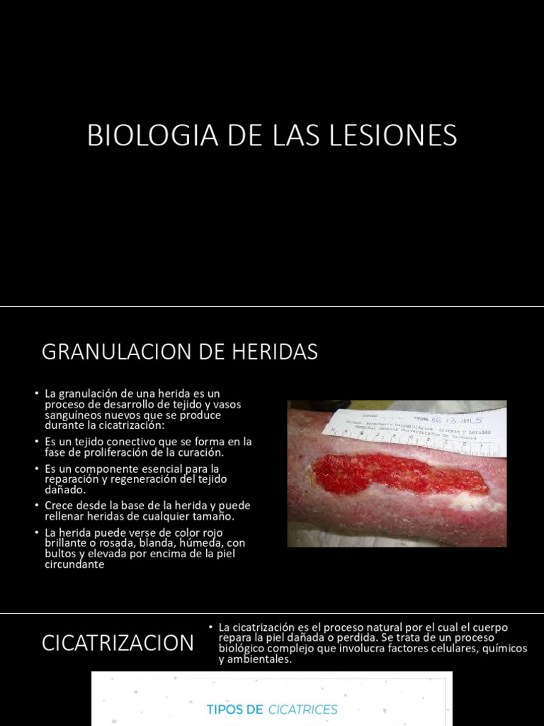 Clase de Lesiones | PDF | Herida | Cicatrización de la herida