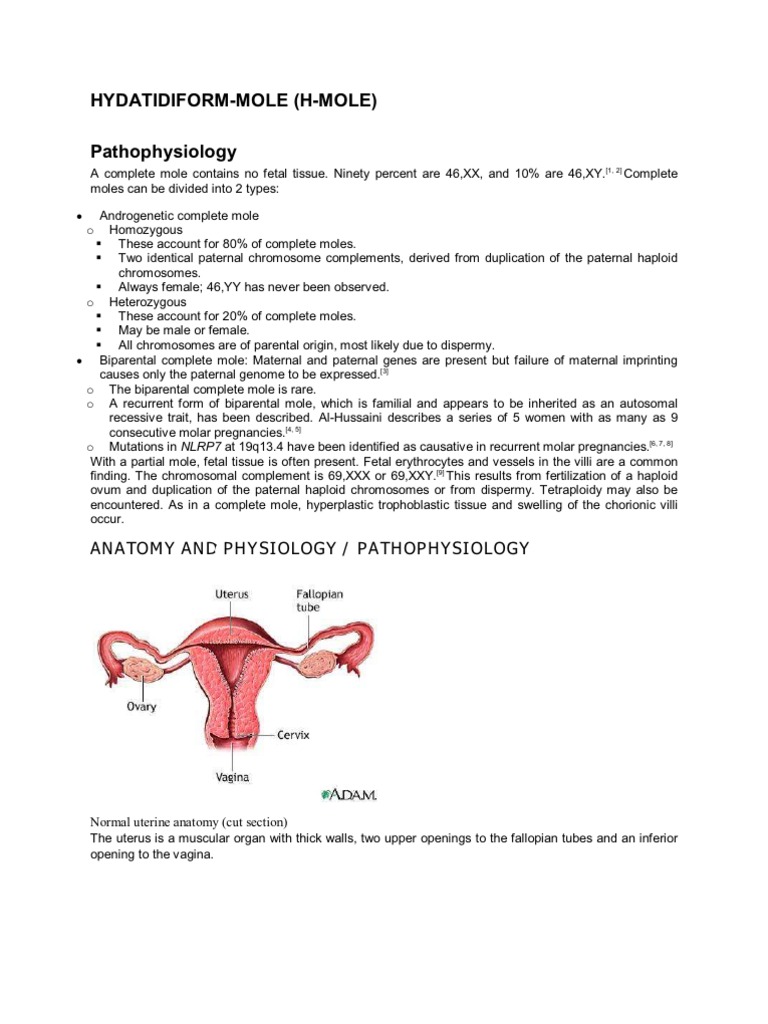 Hydatidiform Mole | PDF