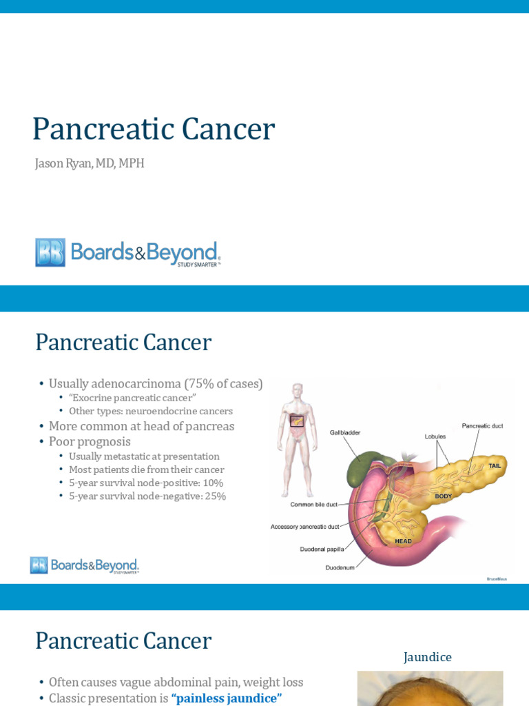 Pancreatic Cancer [Medicalstudyzone.com] | PDF | Pancreatic Cancer | Pancreas