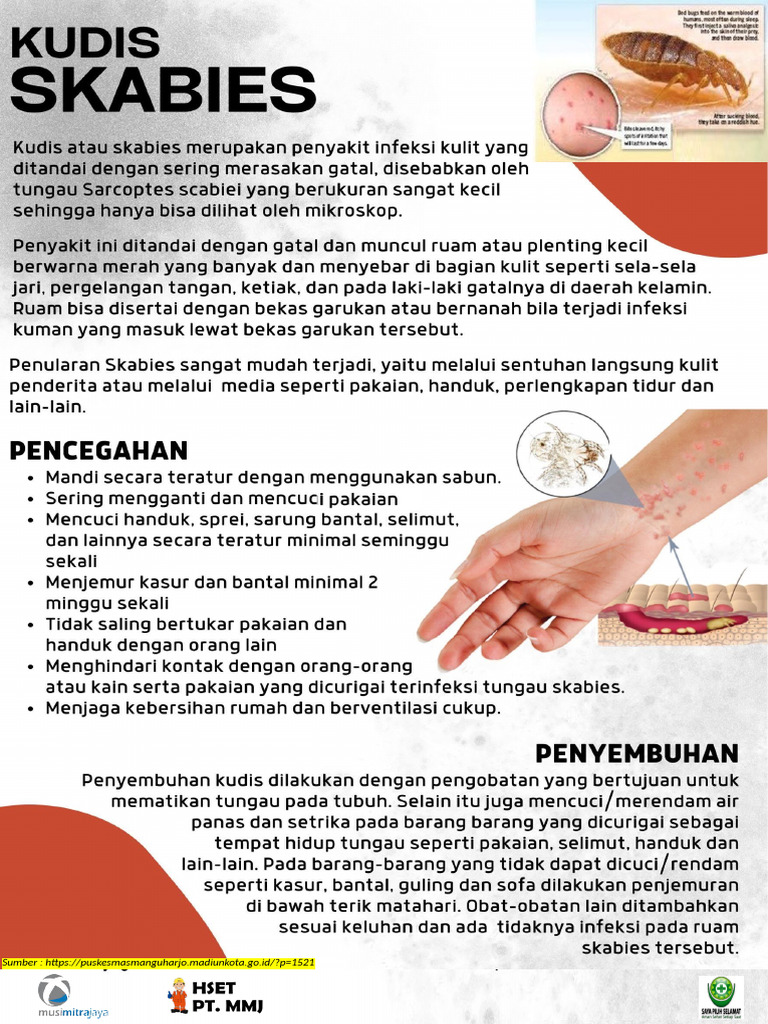 Scabies - Kutu | PDF