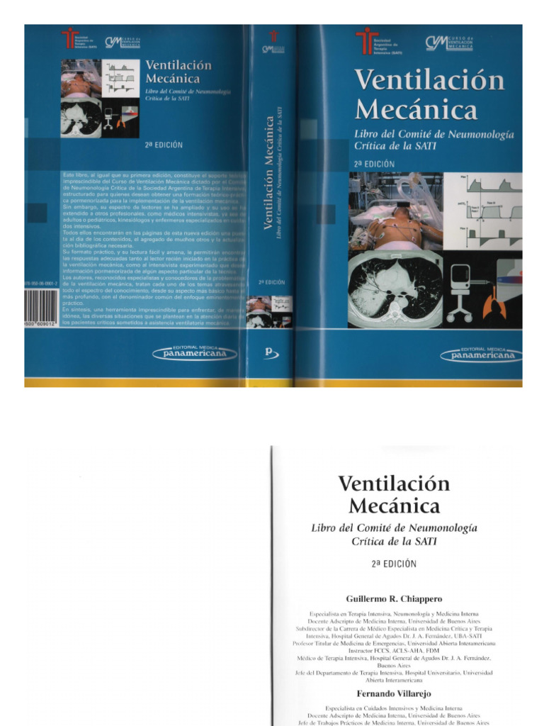 Ventilacion Mecanica | PDF