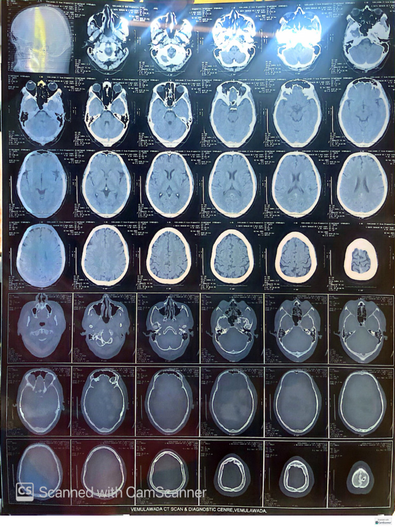 CT Scan | PDF