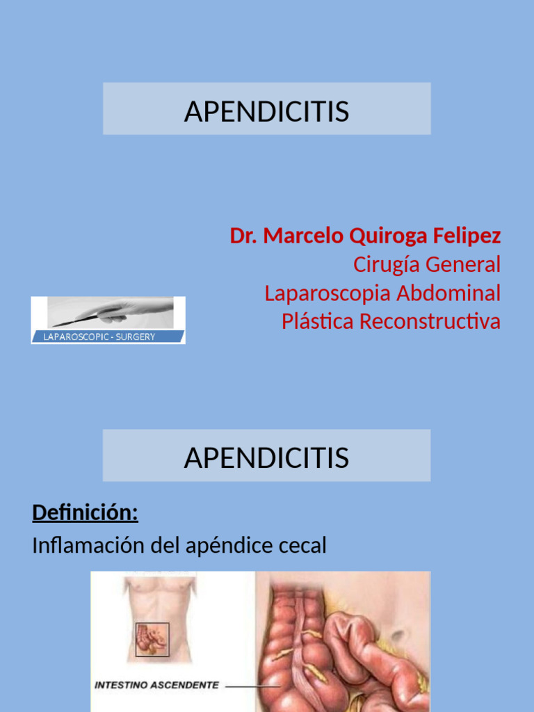 apendicitis | PDF