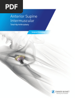 Zimmer Segmental System Distal Femoral Surgical Technique | PDF | Knee ...