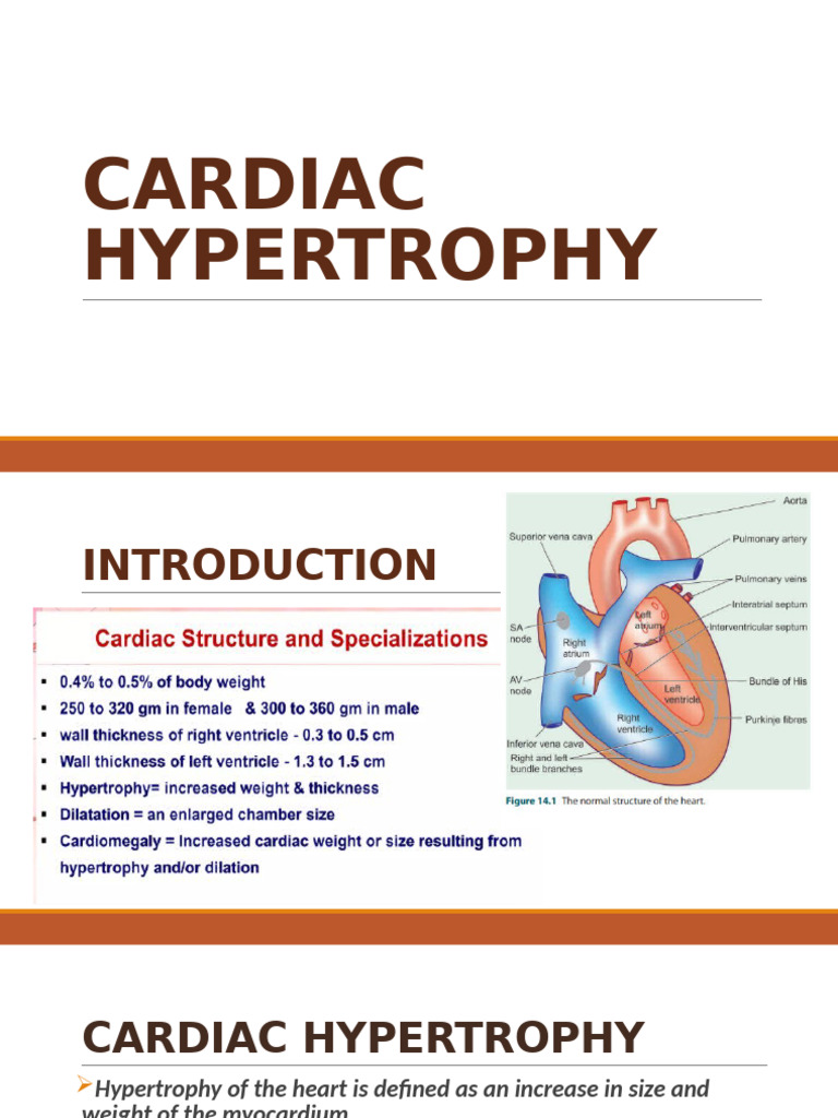 Cardiac Hypertrophy Defined | PDF | Heart | Ventricle (Heart)