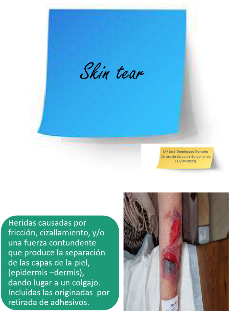 Skin Tear | PDF | Herida | Especialidades Medicas