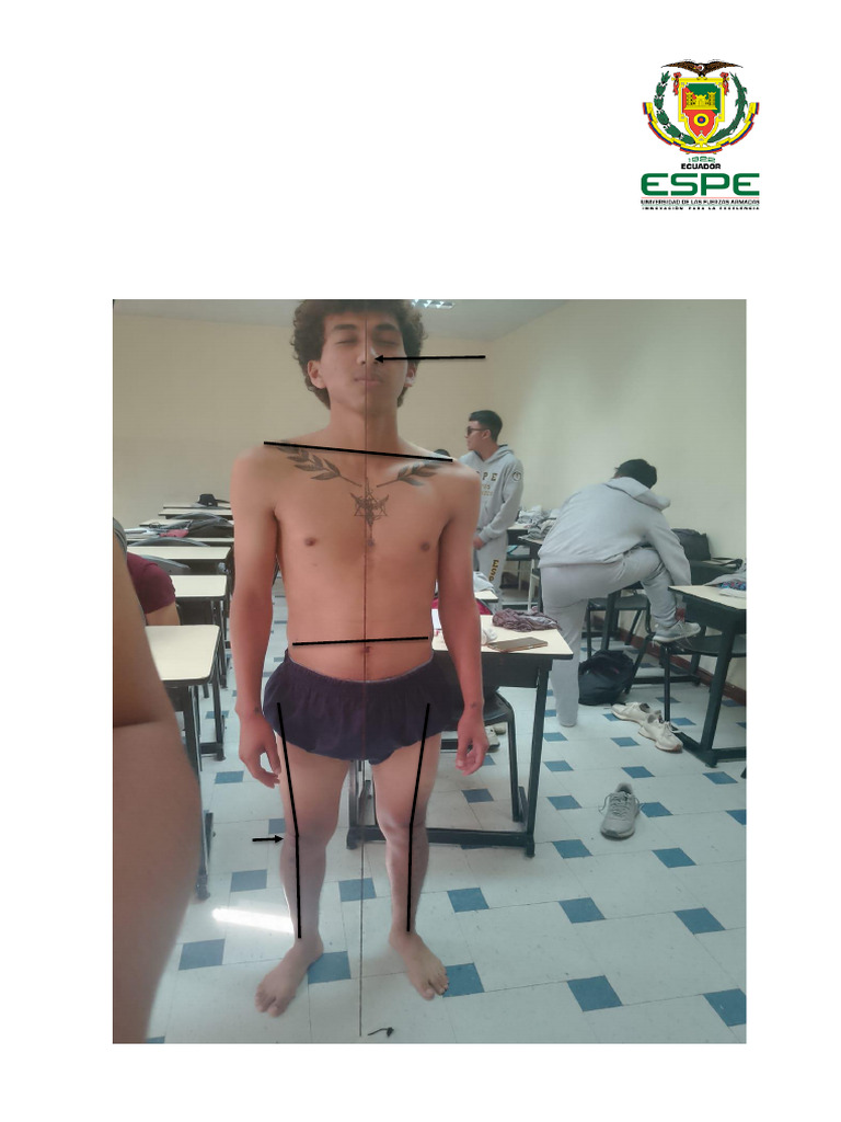 Análisis Postural ANT LAT | PDF