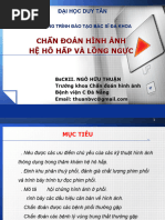 Các dấu hiệu X quang ngực | PDF