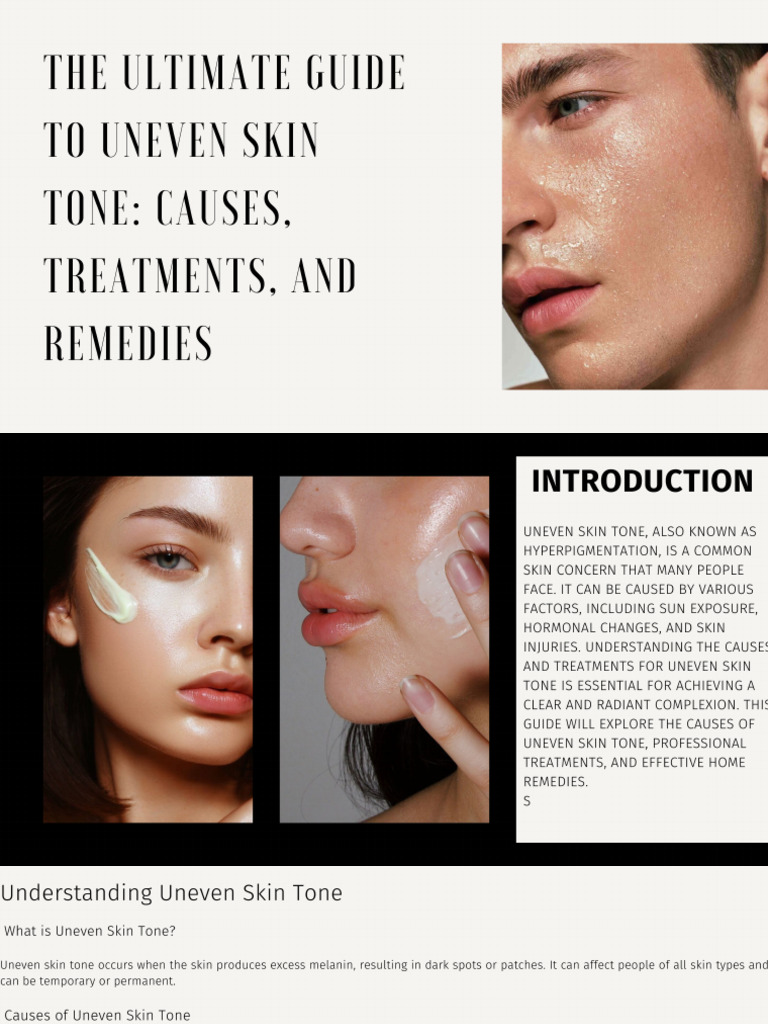 The Ultimate Guide to Treating Pimples Causes, Treatments, and Skincare (2) | PDF