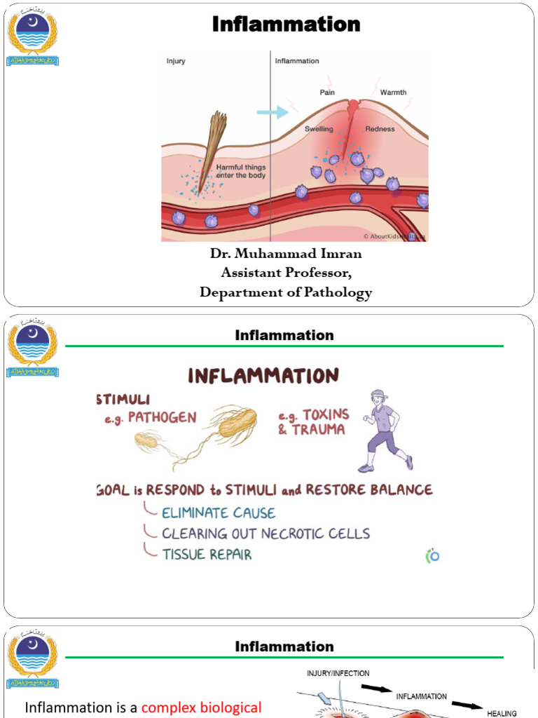 L1-Inflammation, Signs, Receptors, Pathways | PDF | Inflammation ...
