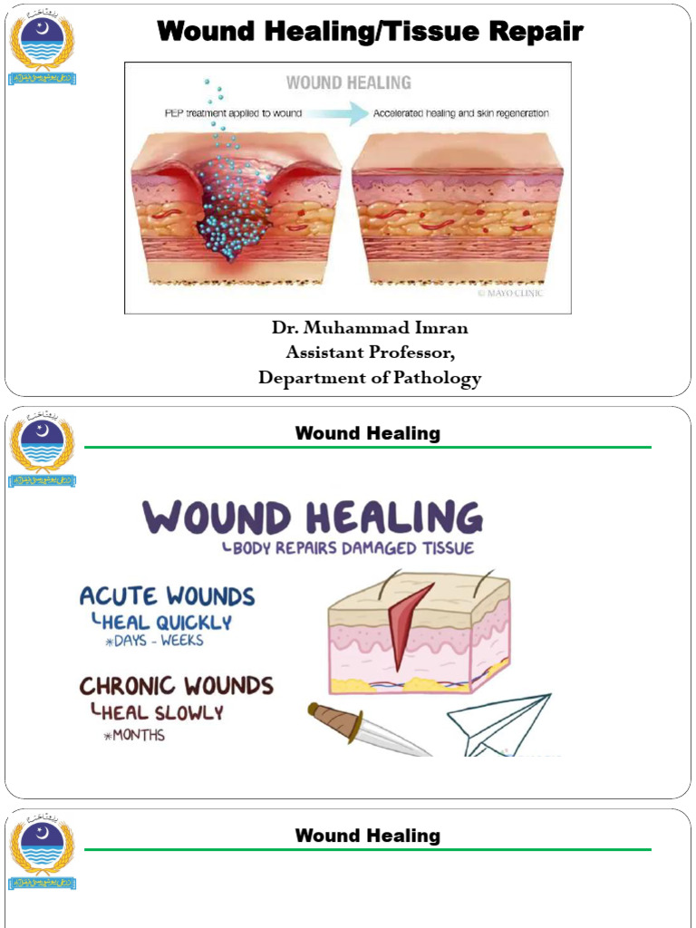 Wound Healing: Cell Types & Healing Phases | PDF | Wound Healing | Wound