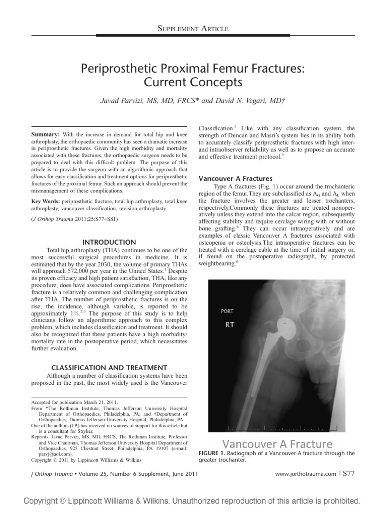 Periprosthetic Proximal Femur Fractures Current.11 | PDF | Hip | Prosthesis