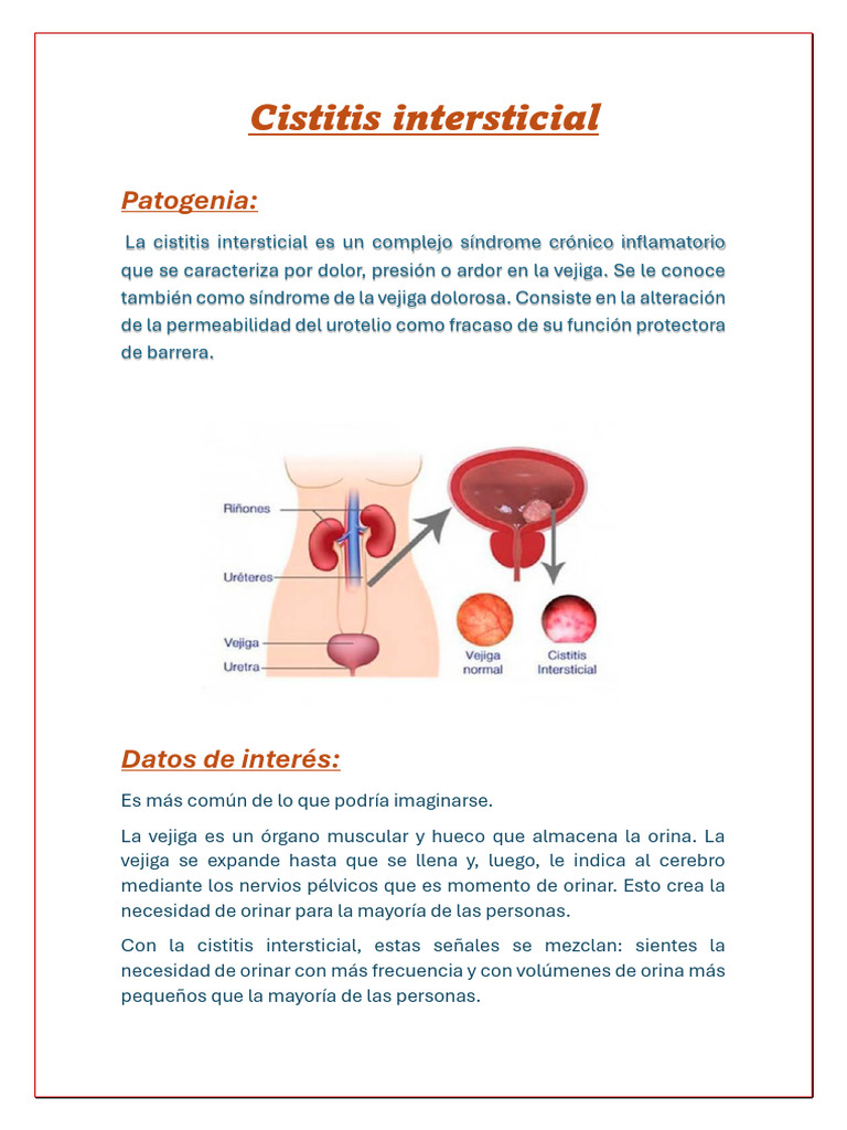 Guía sobre Cistitis Intersticial | PDF | Infección del tracto urinario ...