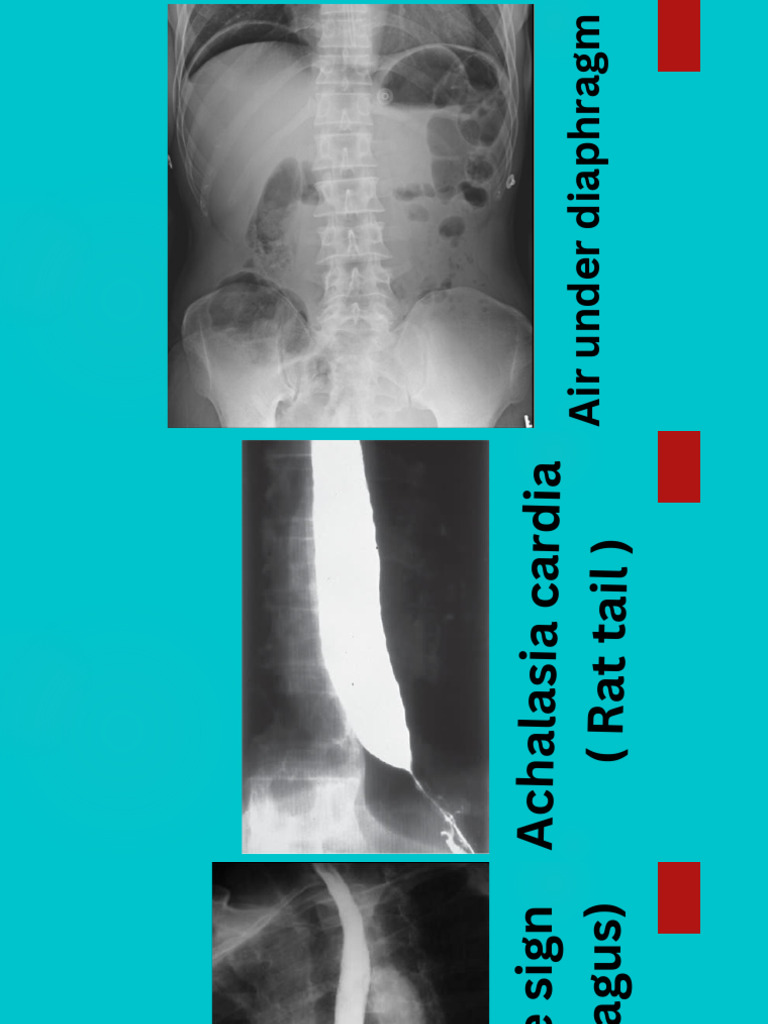 UG Exam X Rays | PDF
