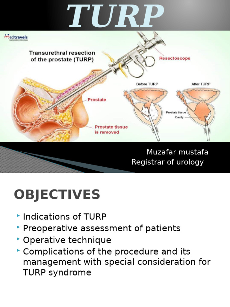 TURP Procedure: Indications & Management | PDF | Causes Of Death | Medicine