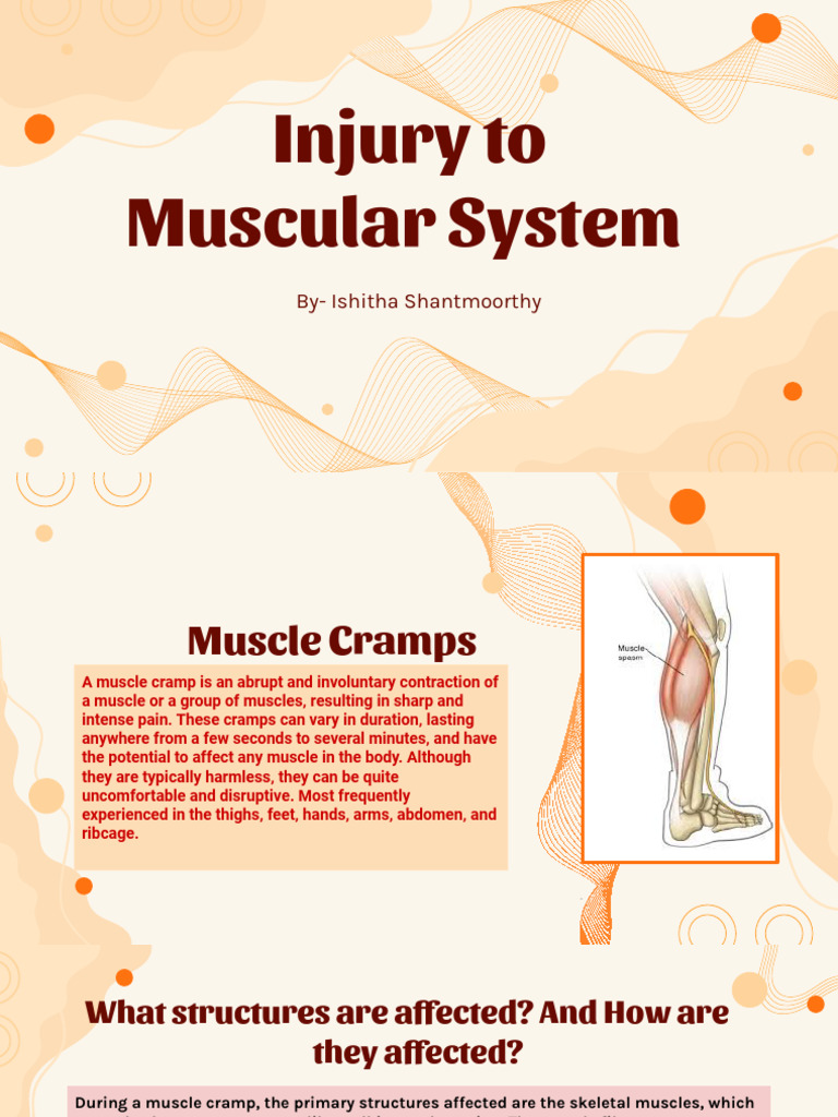 Understanding Muscle Cramps and DOMS | PDF | Clinical Medicine ...
