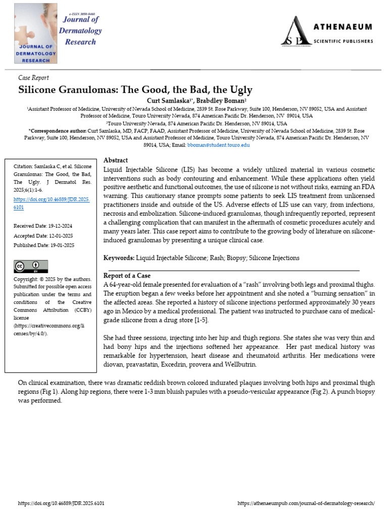 Silicone Granulomas the Good the Bad the Ugly | PDF | Macrophage | Monocyte