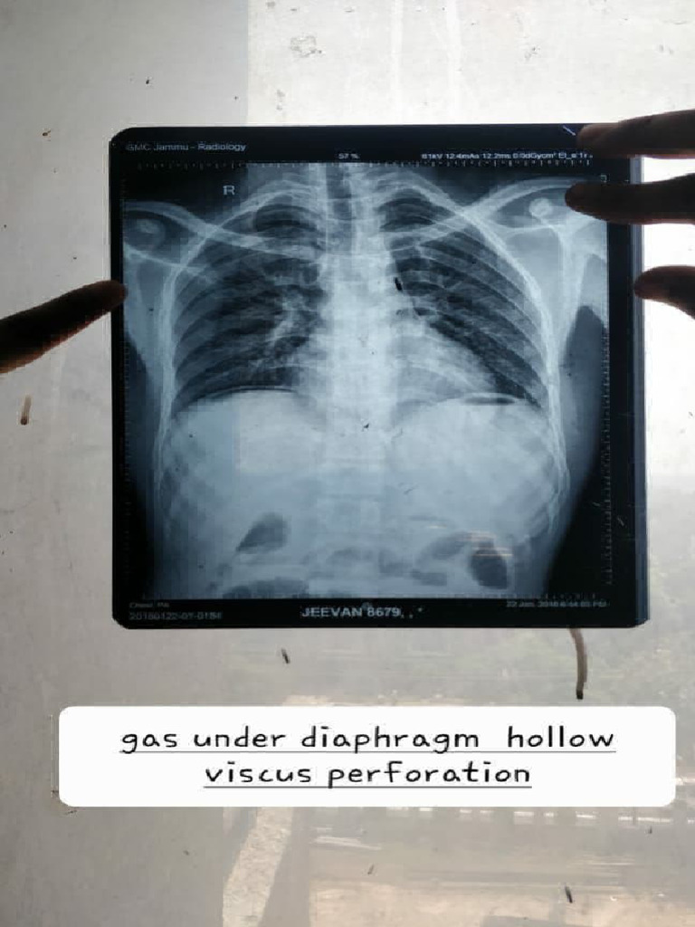 X Rays Surgery | PDF