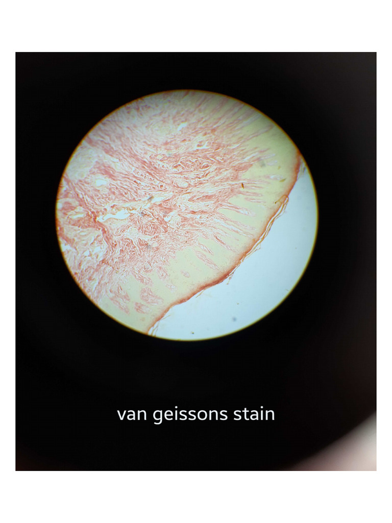 DH Slides & Cast Specimen | PDF