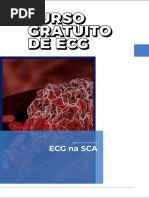 Quais Os Critérios Eletrocardiográficos de Infarto Com Supradesnivelamento de ST - CardioPapers ...
