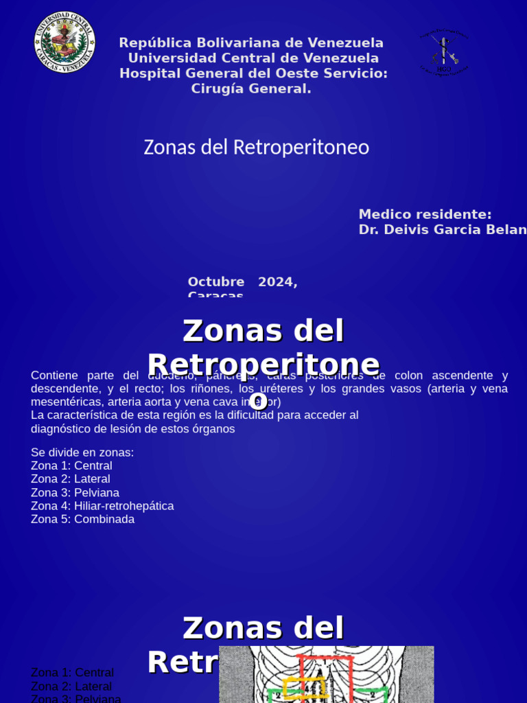 Zonas del Retroperitoneo en Cirugía | PDF