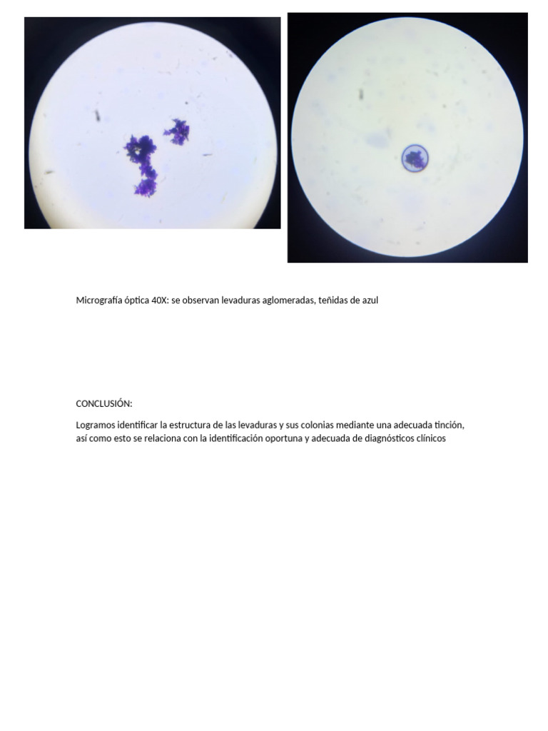 Conclusión y Resultados Bacter | PDF